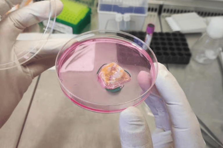 UAE initiates a First TILs Cancer Therapy Program.